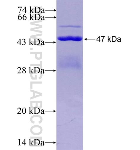 Tctex1d1 Fusion Protein United Bio Research