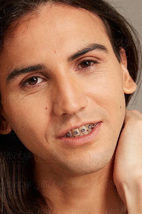 Braces Closeup By Stocksy Contributor Ohlamour Studio Stocksy