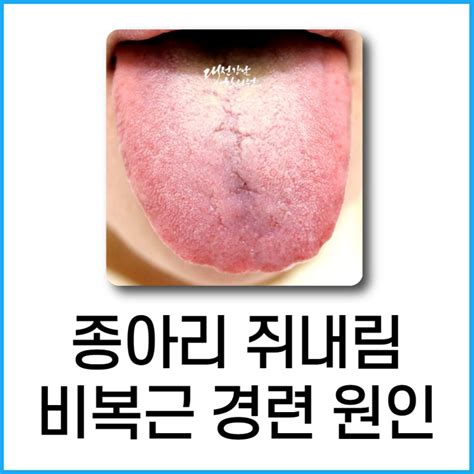 누우면 종아리에 쥐가 나요 다리경련 원인은 네이버 블로그