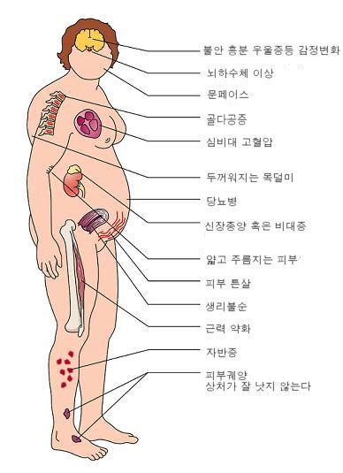 스테로이드 부작용 2 스테로이드 부작용과 쿠싱증후군의 증상들 네이버 블로그