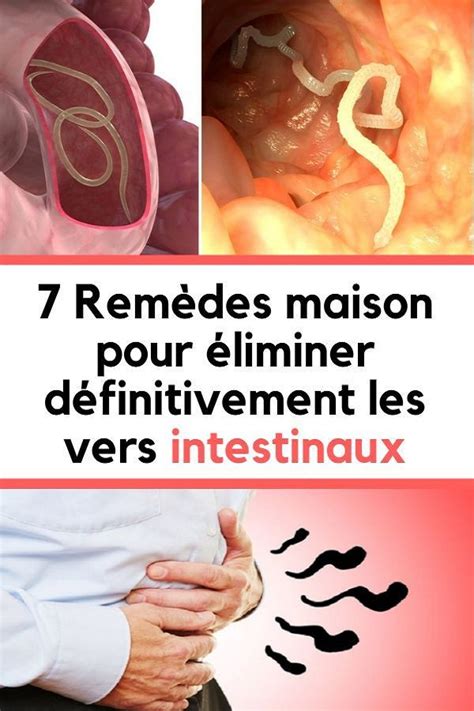 Se Débarrasser Des Vers Intestinaux AlloDocteurs