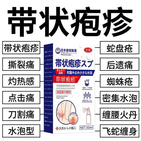 带状疱疹后遗症神经痛蛇盘疮飞蛇缠腰龙外用汗疱疹膏蛇胆疮拔毒膏lning Shopee Malaysia