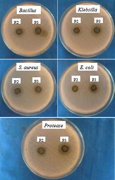 Antibacterial Activity Of Bio Synthesized Ag Nanoparticles Download Scientific Diagram