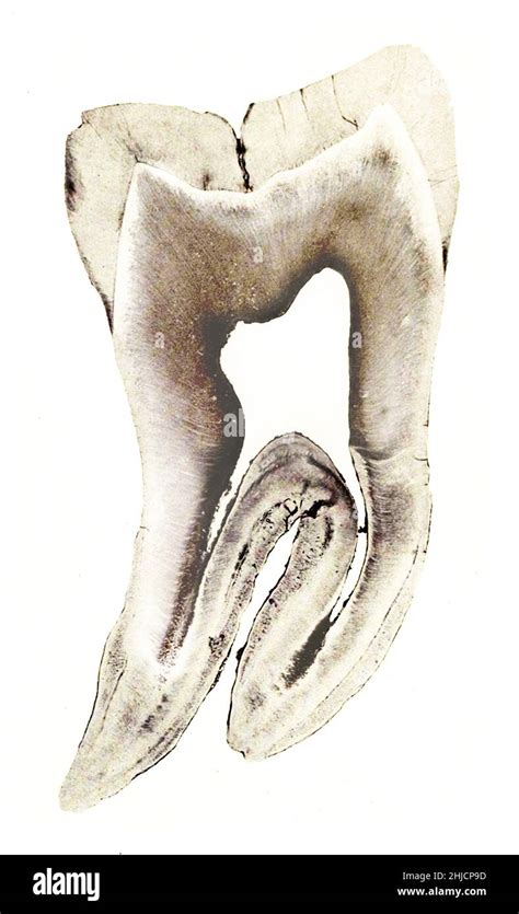 Human Tooth Microscope Cut Out Stock Images And Pictures Alamy