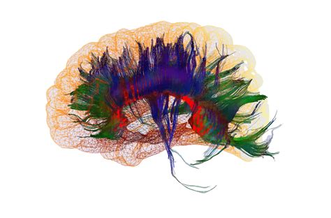 Montreal Paris Neurobank Data Modalities