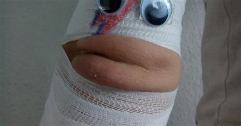 Context Album On Imgur