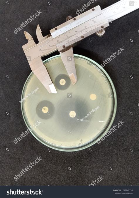 Zone Inhibition Test Antimicrobial Activity Foto Stock 1737740735