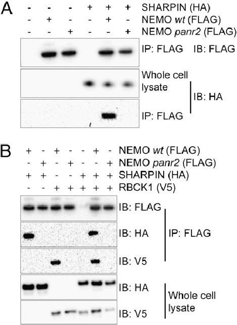 Sharpin Interacts With Nemo In A Manner Abrogated By The Panr2