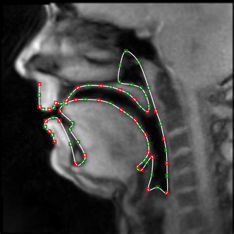 Illustrative Examples Of The Automatically Segmented Vocal Tract Download Scientific Diagram