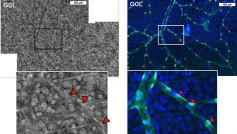 Ex Vivo Observation Of A Rat Neuroretina At The Ganglion Cell Layer