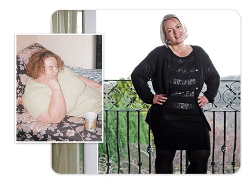 Zoes Gastric Bypass Story Success Stories Healthier Weight