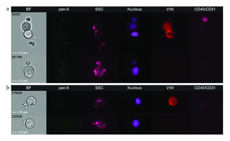 Representative Pictures Of Circulating Tumor Cells Download Scientific Diagram