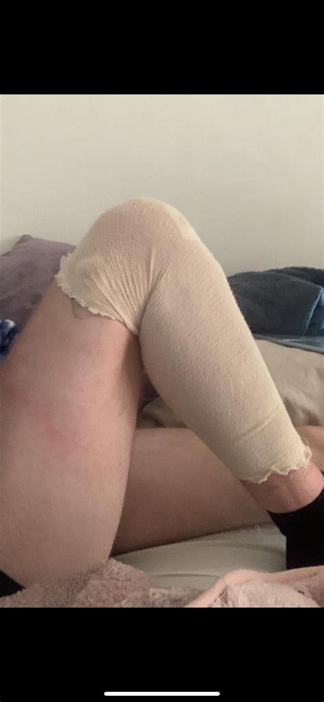 Day 5 Post Acl Reconstruction Hamstring Graft First Physio Today And Starting To Feel Positive