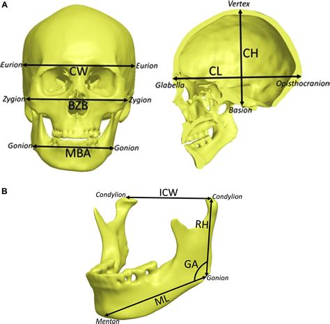 Temporomandibular Joint Condyledisc Morphometric Sexual Dimorphisms