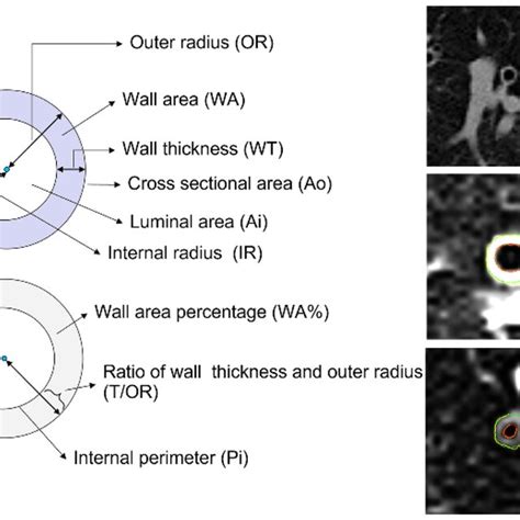 Spirometry And Lung Airway Resistance Parameters According To The