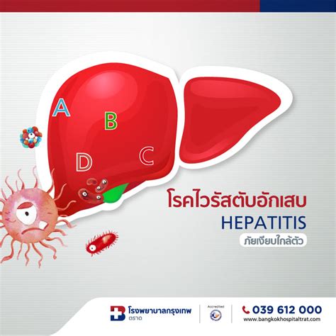 โรงพยาบาลกรุงเทพตราด 👩‍⚕️โรคไวรัสตับอักเสบภัยเงียบ ก่อมะเร็ง จากข้อมูลขององค์การอนามัยโลก ปี