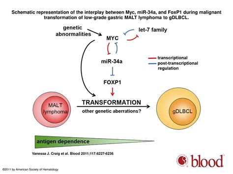 Myc Mediated Repression Of Microrna 34a Promotes High Grade