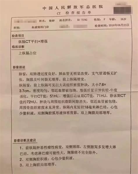 90 後演員徐婷去世：淋巴瘤這些知識你不可不知 每日頭條