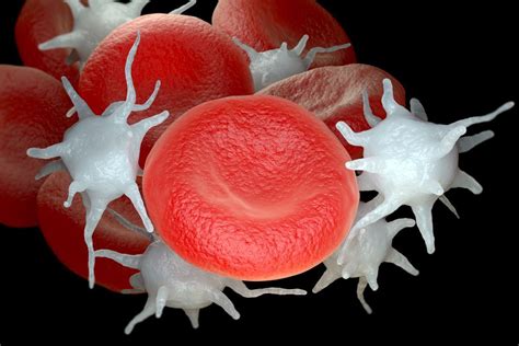 40 Facts About Essential Thrombocytopenia