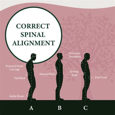 Correct Spinal Alignment — Chiropractor Queanbeyan And Canberra