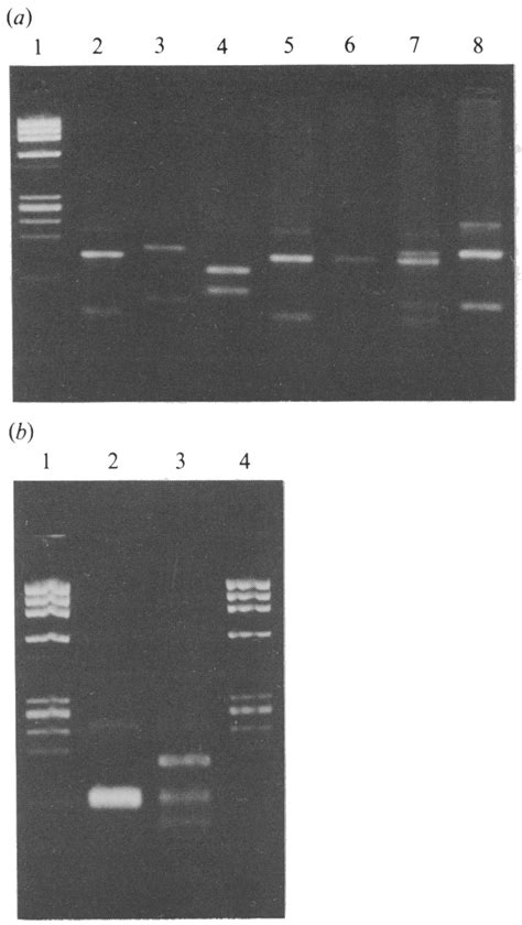 Typing Of Clinical Samples By Restriction Enzyme Analysis Carcinoma