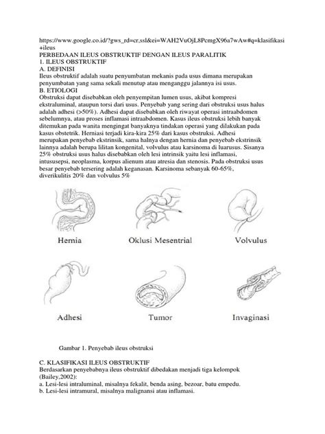 Perbedaan Ileus Obstruktif Dengan Ileus Paralitik Pdf Sains And Matematika