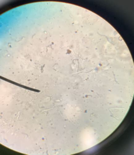Parasitology Lab Exam 1 Flashcards Quizlet