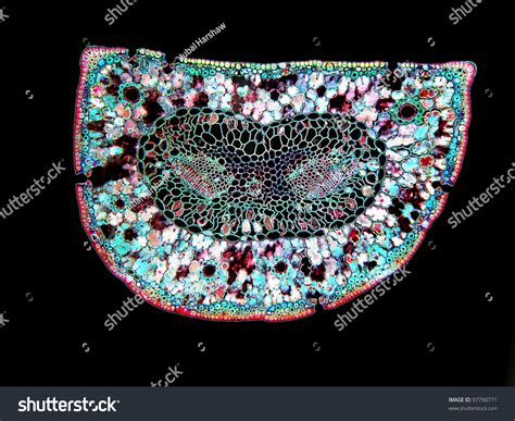 Pine Leaf Cross Section