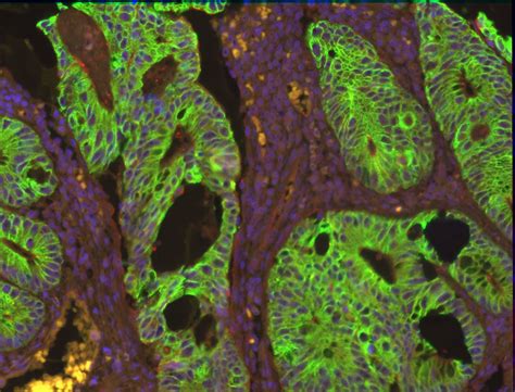 An Approach To Large Bowel Diarrhoea Vetscentral Library