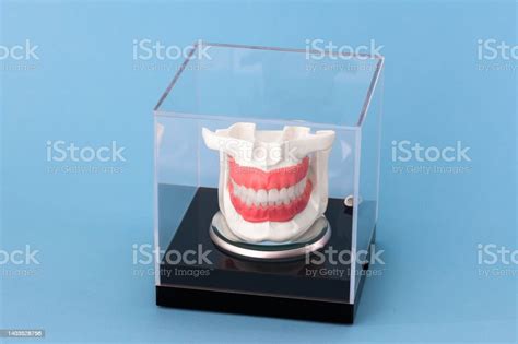 치아가있는 인간의 턱은 유리 상자의 파란색 배경에 고립 된 해부학 모델을 이식합니다 0명에 대한 스톡 사진 및 기타 이미지