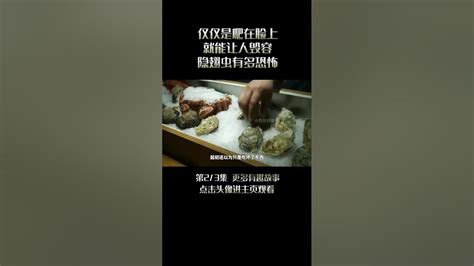 Pt23 8个月大婴儿眼里，竟取出8条活虫，寄生虫入侵之后有多恐怖【西风探瘦马】shorts Youtube