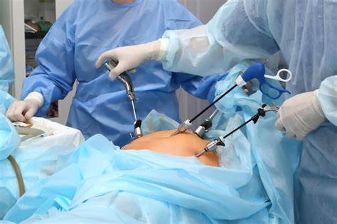 Premium Photo Operation On The Stomach Medical Procedure For Treating