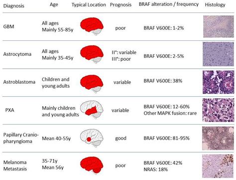 Oncogenic Braf Alterations And Their Role In Brain Tumors