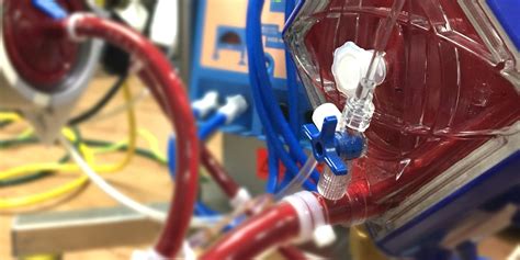Extracorporeal Life Support