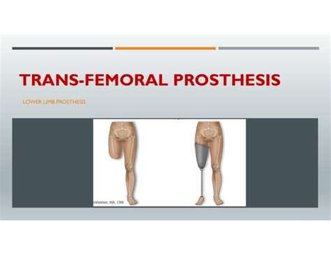 Prosthesis 15 Transfemoral Prosthesis Pdf