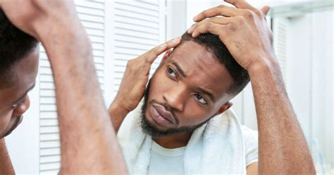 Wart On Scalp Causes Side Effects Risks And Treatment