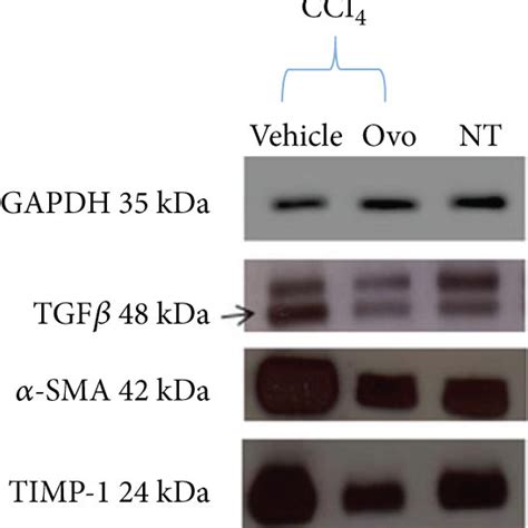 Protein Expression Of Liver Fibrosis Markers A A Representative