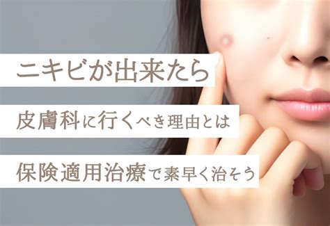 ニキビが出来たら皮膚科に行くべき理由とは・保険適用治療で素早く治そう！ Fabeaute