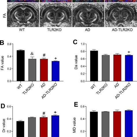 White Matter Integrity Evaluated By Dti Images Detected By 7 Tesla Mri
