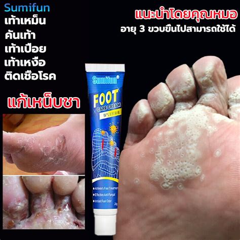 ของแท้100sumifun ครีมระงับกลิ่นเท้า ที่มีประสิทธิภาพ100 ครีมรักษาเชื้อ