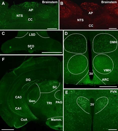 Distribution And Characterisation Of Glucagon Like Peptide 1 Receptor