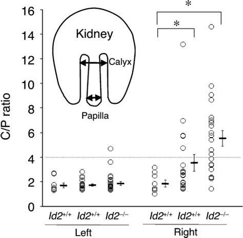 Id2 Haploinsufficiency In Mice Leads To Congenital Hydronephrosis Resembling That In Humans