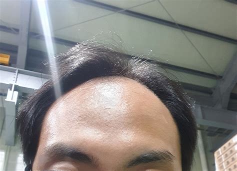 건강검진 결과 포텐 터짐 최신순 에펨코리아