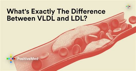 Whats Exactly The Difference Between Vldl And Ldl Positivemed