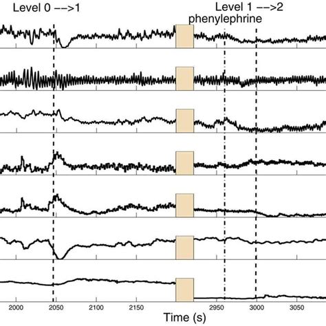 A Simplified Diagram Of The Cardiovascular Closed Loop Model The Download Scientific Diagram