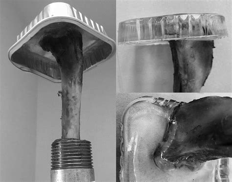 Canine Tibia Fixed With Polymethyl Methacrylate PMMA Distally And