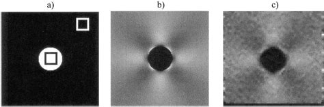 Figure 1 From A Quantitative Comparison Of Modulus Images Obtained