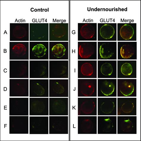 Effect Of Latrunculin B Treatment On The Subcellular Localization Of