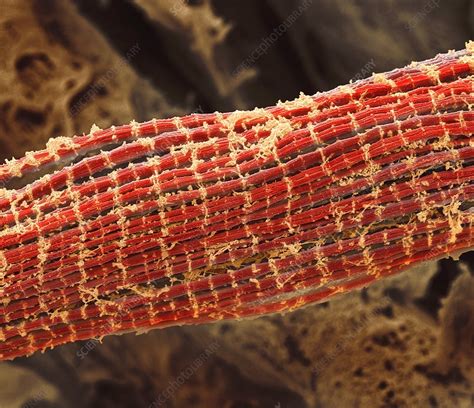 Skeletal Muscle Fiber Microscope