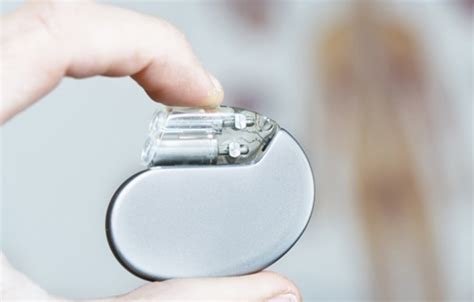 Private Pacemaker Implantation Procedure Cardiology